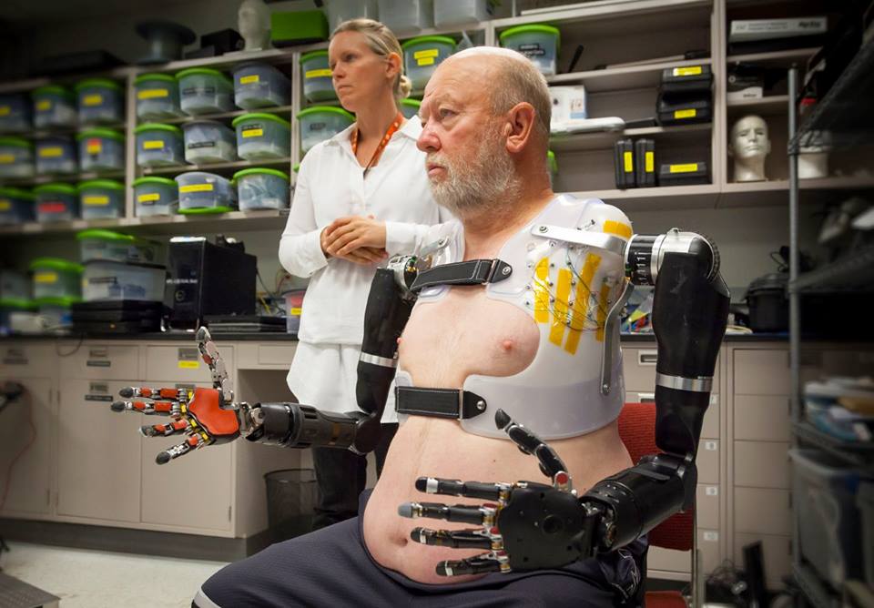 Revolutionary artificial limbs using signals from the brain